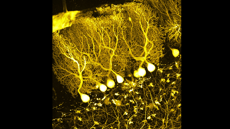 Purkinje Cells