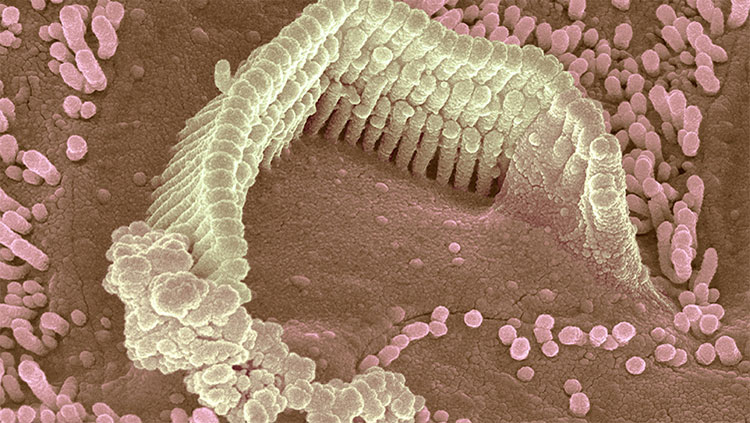 Hair Cells