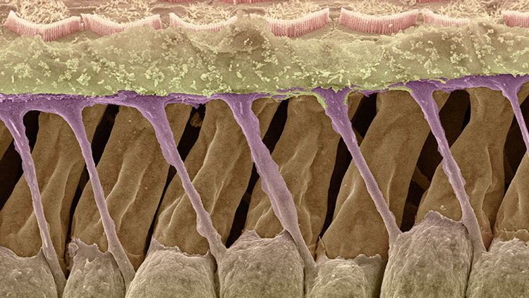 Holding the Inner Ear Together